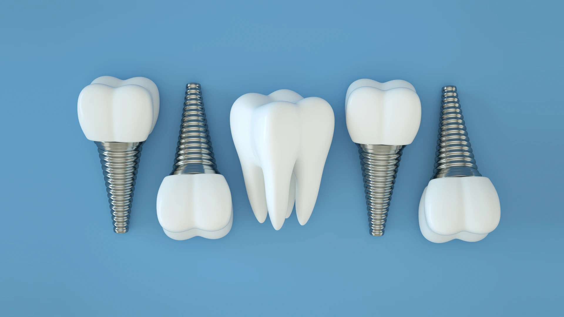 Dental Implant Risks & Side Effects: What Patients Should Know